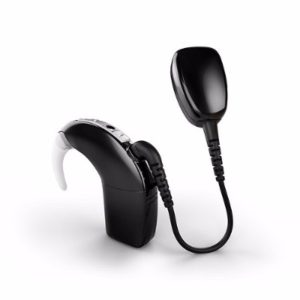 Cochlear Baha | Happy Ears Hearing Center