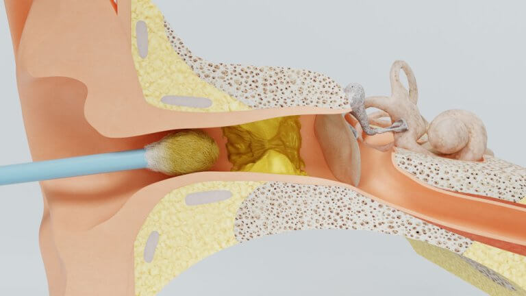 How to Properly Clean Your Ears - Audiologist's Advice